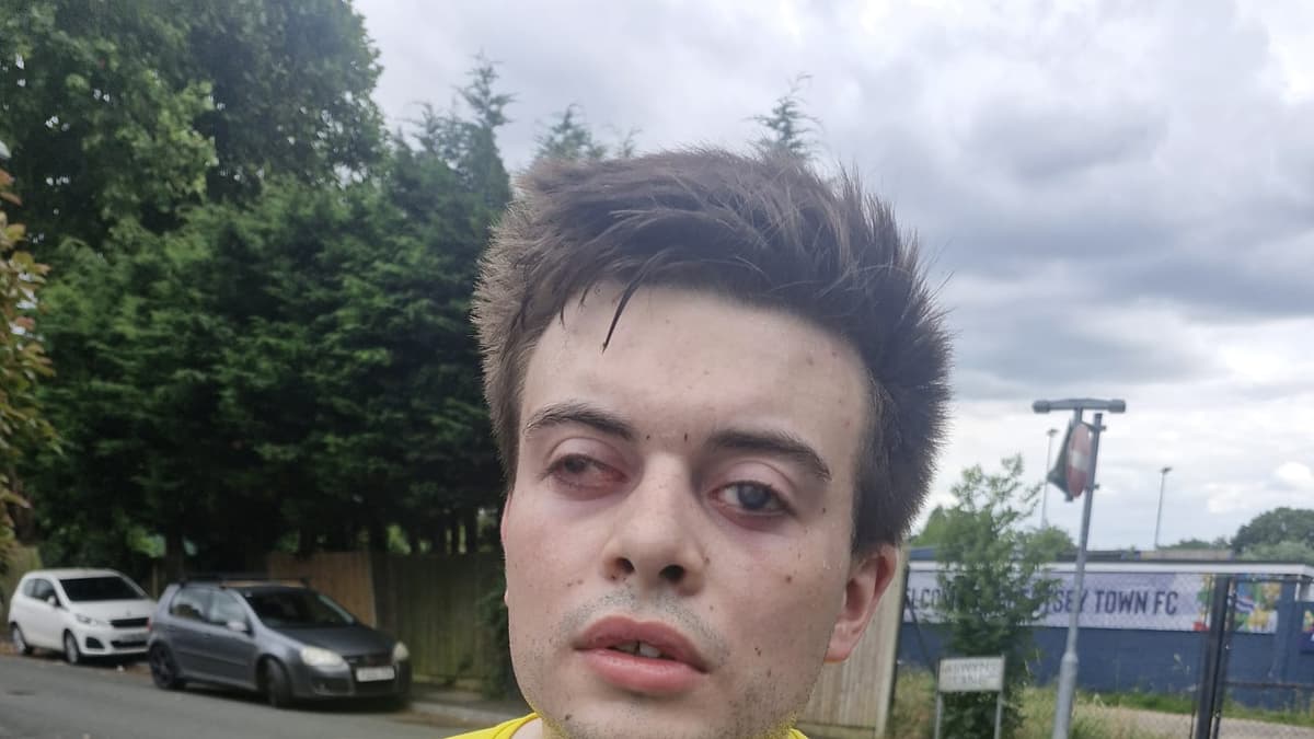 Blind Lee to take on his hardest fundraising challenge yet ...